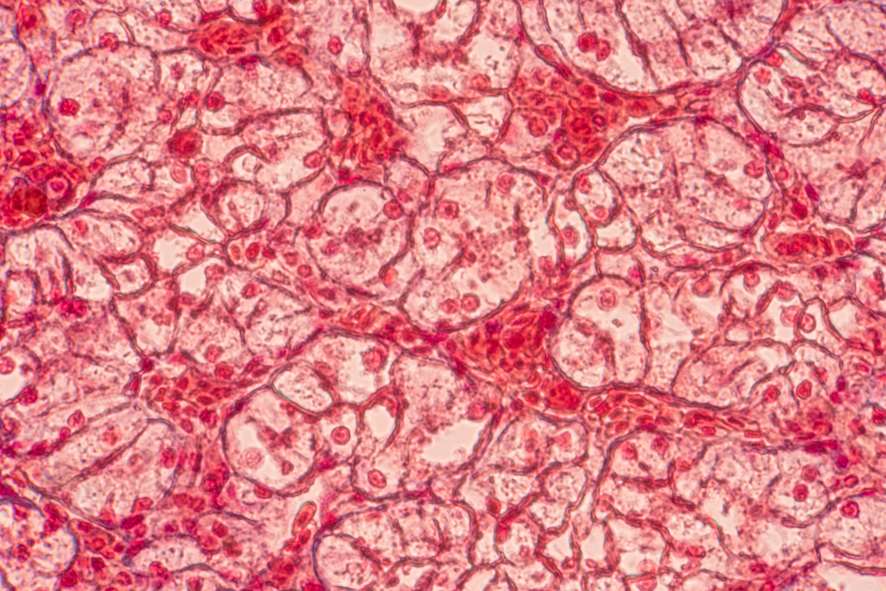 What is Altered intercellular communication and how to counter it! - XBrain